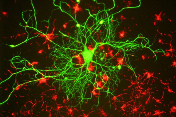 Alternative methods for determining neurotoxicity | Animal Welfare Body ...